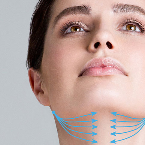 نخ آپتوس (HA) Excellence Visage - نارون تجهیز طب